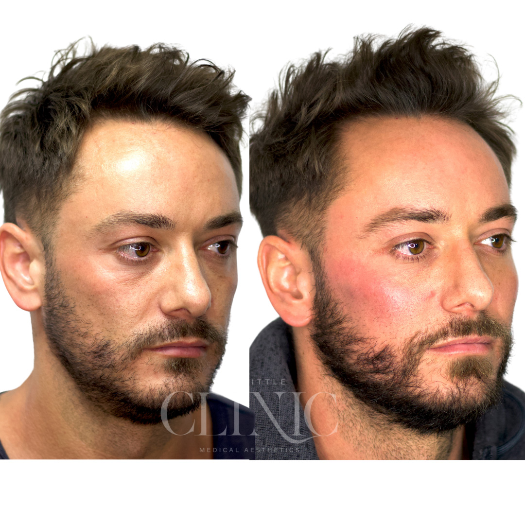 Testimonials | TLC Medical Aesthetics