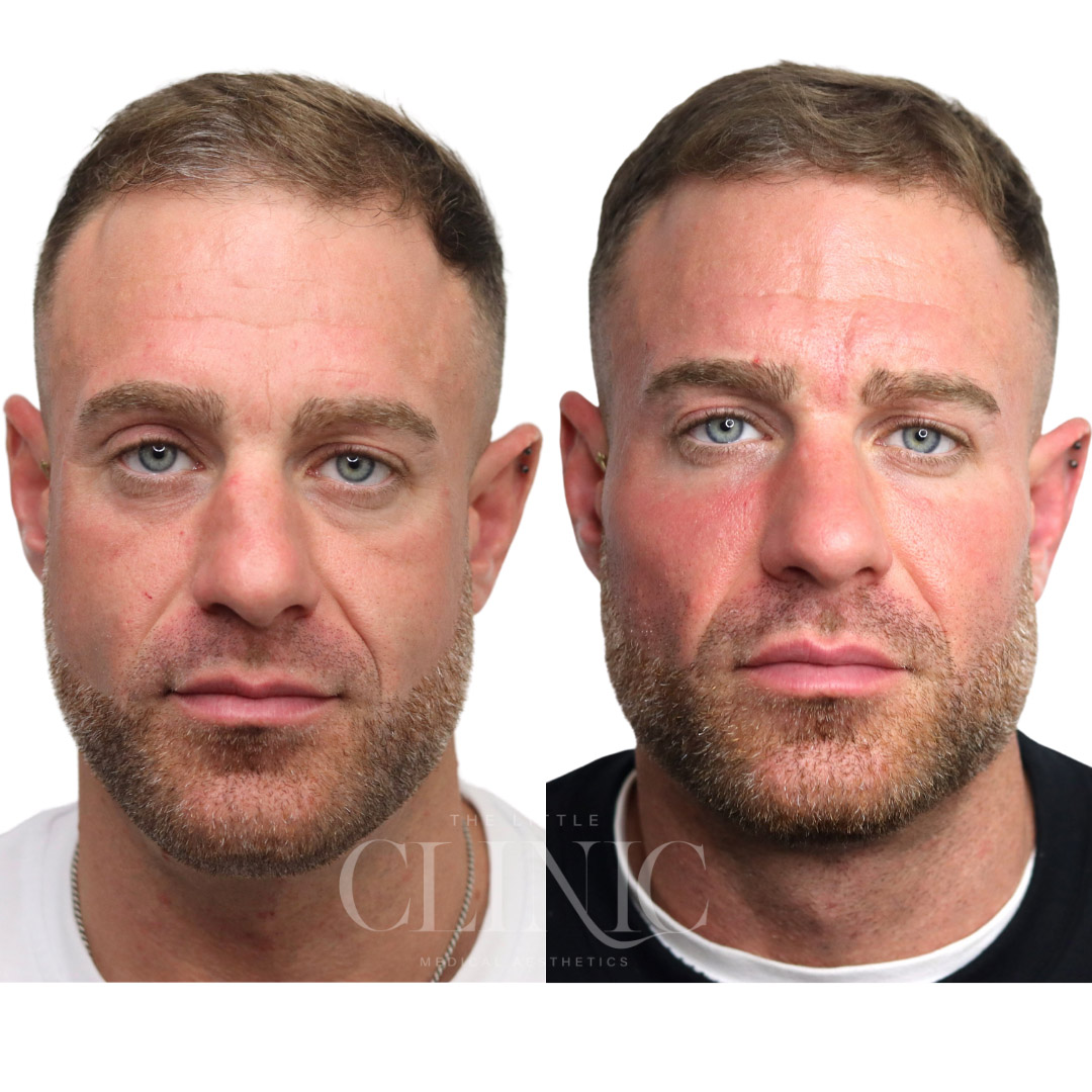 Testimonials | TLC Medical Aesthetics